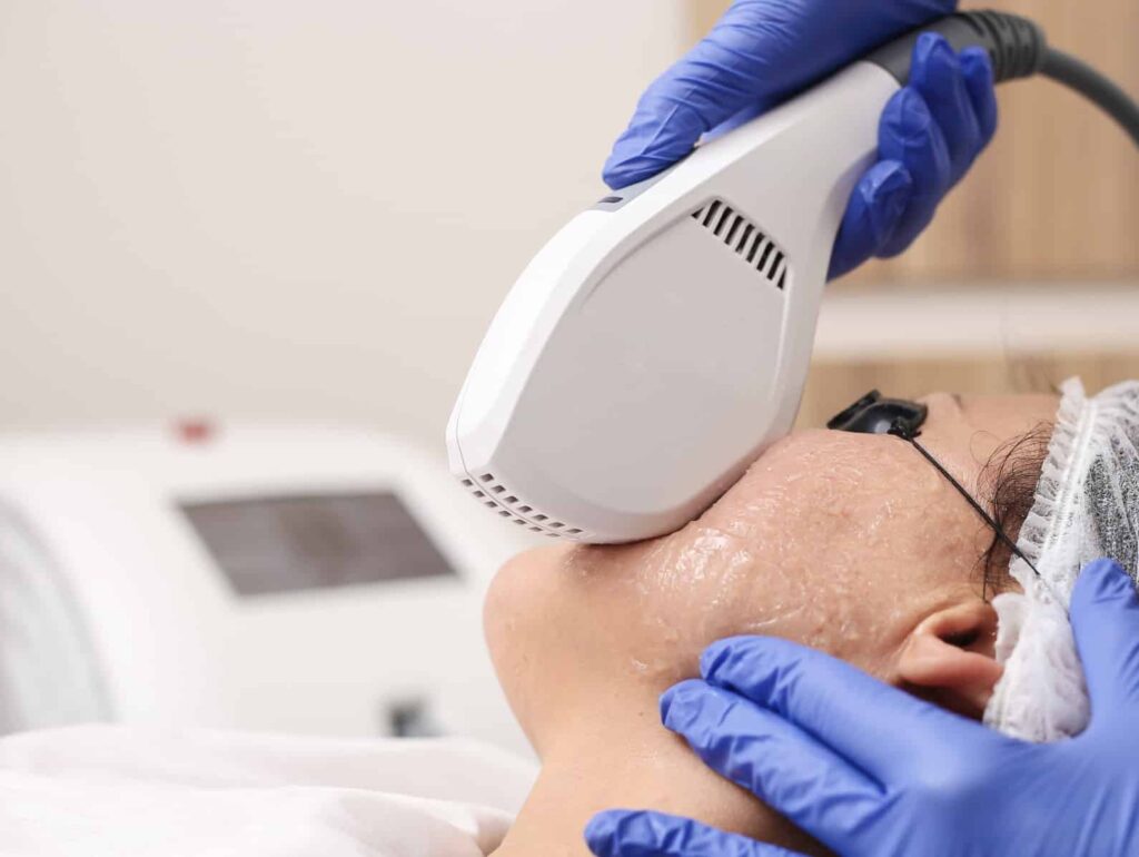 Photorejuvenation by Intense Pulsed Light - IPL | Skin Marceau | Paris 16